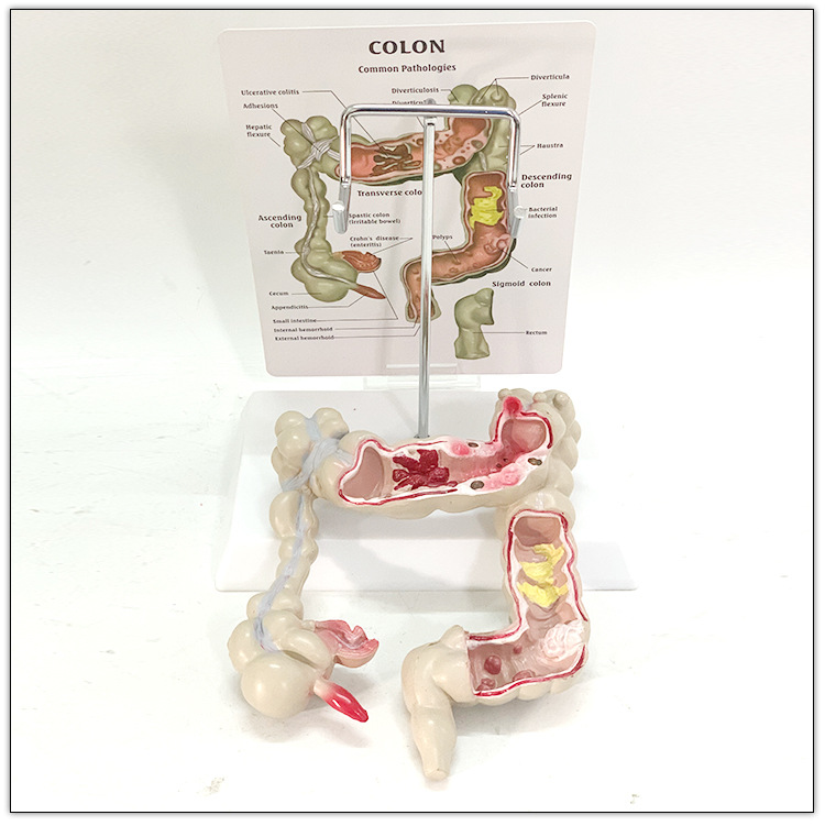 Medical Human Anatomical Intestine Model - CJdropshipping
